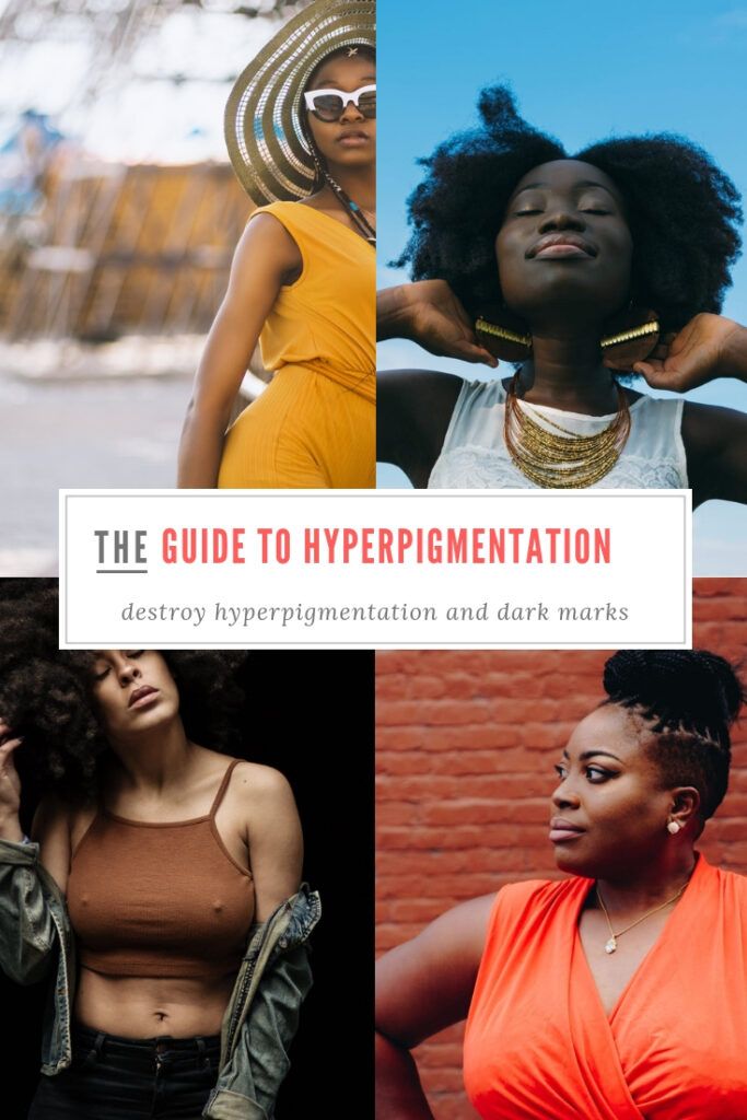 Got Hyperpigmentation? Here are 3 Easy Steps to Fight It!